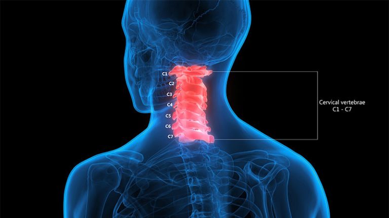 What is the most common cervical spine injury? - New Delhi Spine New Blogs